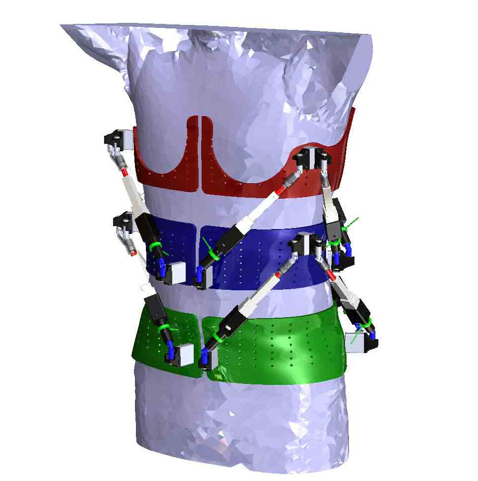 First Dynamic Spine Brace—Robotic Spine Exoskeleton—Characterizes Spine ...